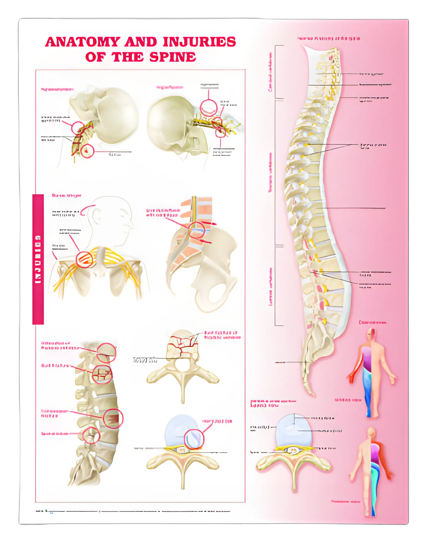 Anatomical Chart Anatomy and Injuries of the Spine 20 X 26 Inch Heavy ...